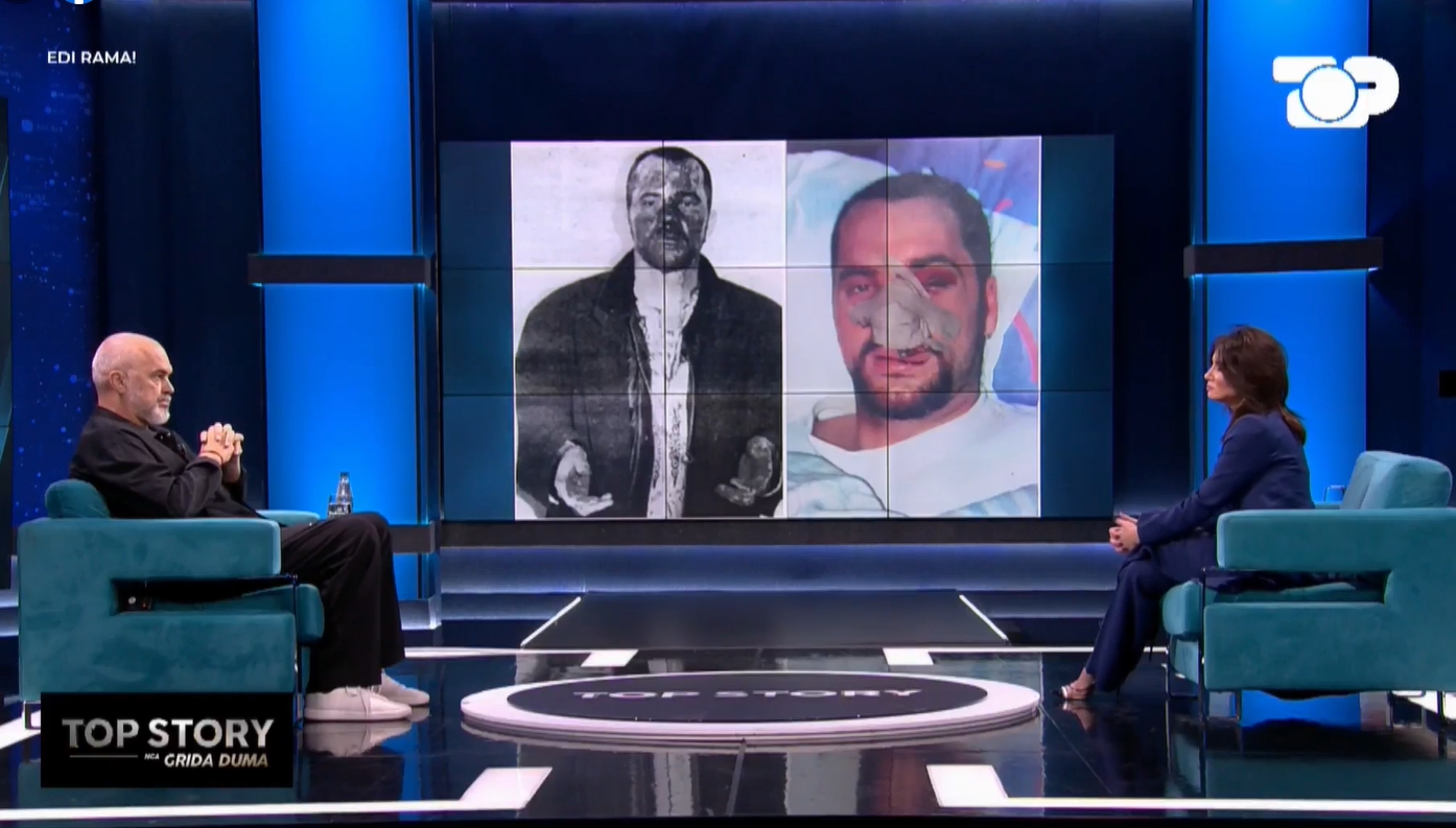 “Mund të ndodhte gjithçka”/ Edi Rama rrëfen për herë të parë rrahjen ...