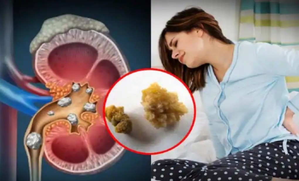 Keni kriza të padurueshme? Aplikoni gjashtë mënyrat natyrale si të ...