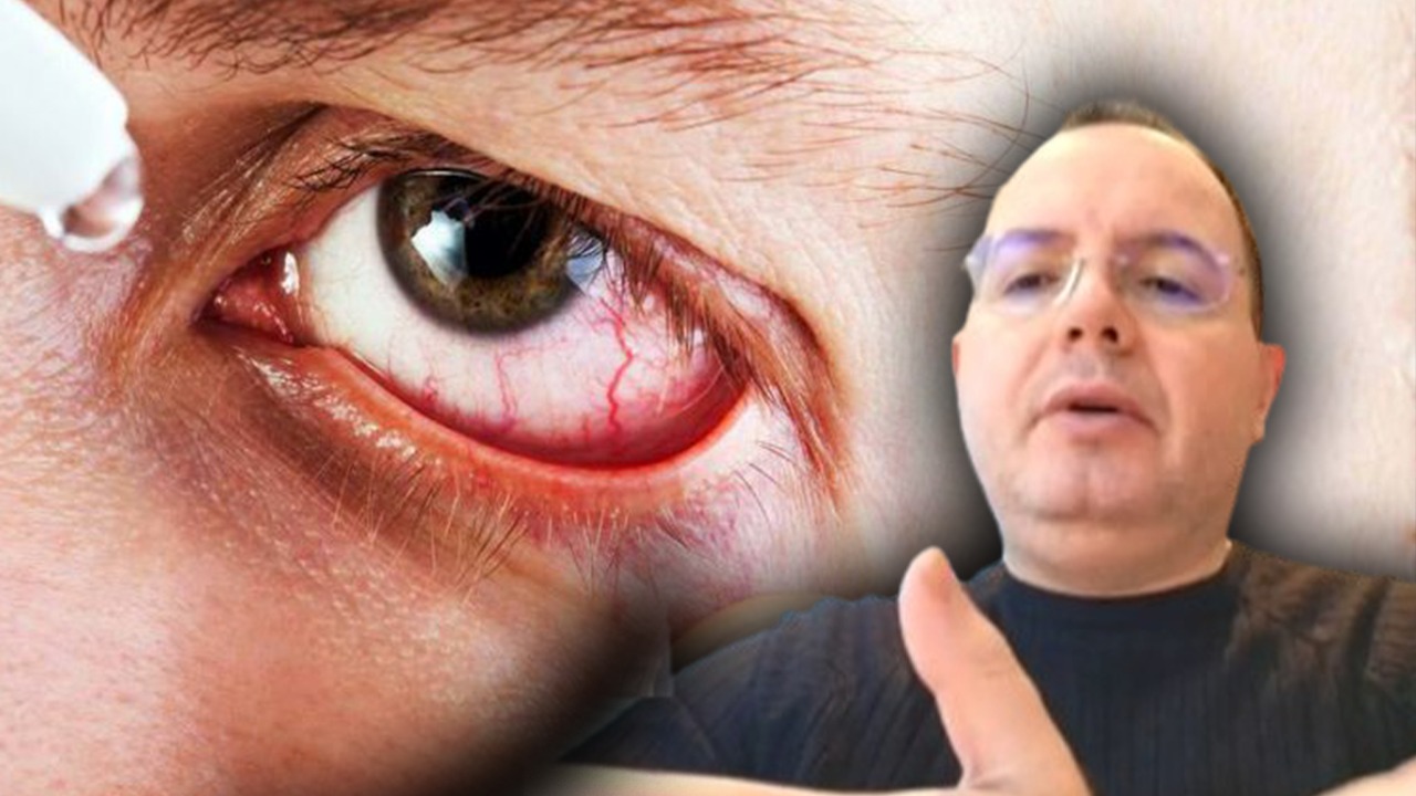 “Gripi i syrit”, mjeku okulist tregon gabimin që bëjnë pacientët: Ka ...