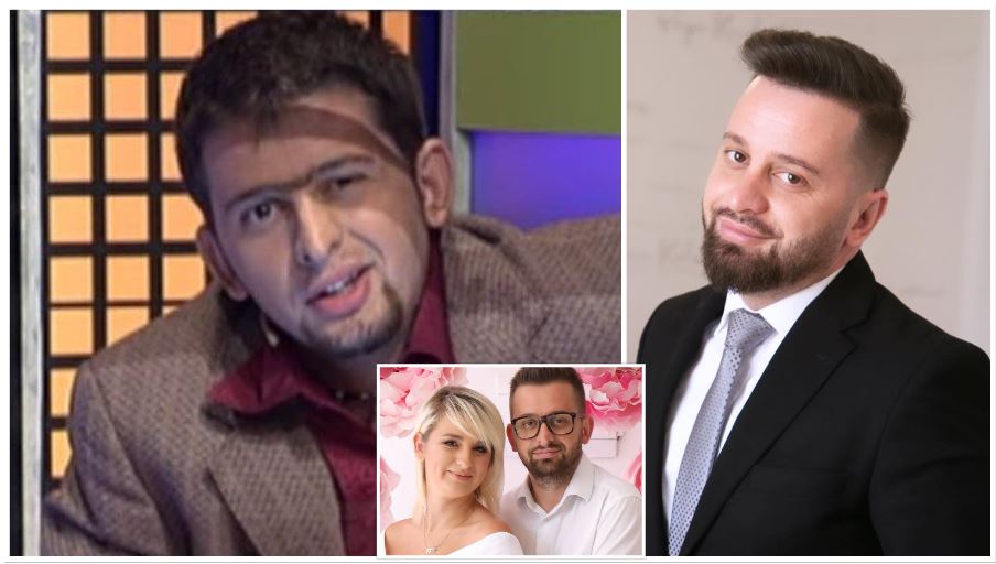 Erion Isai thyen heshtjen: Nga operacionet plastike deri te ...