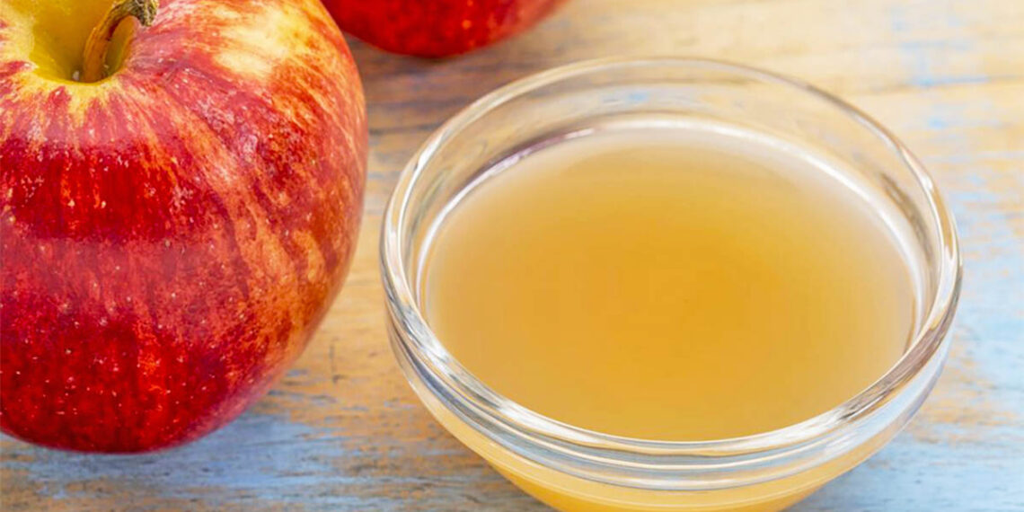 Bën mrekulli/ Ja si të pastroni rrënjësisht flokët nga yndyra, zbokthi ...